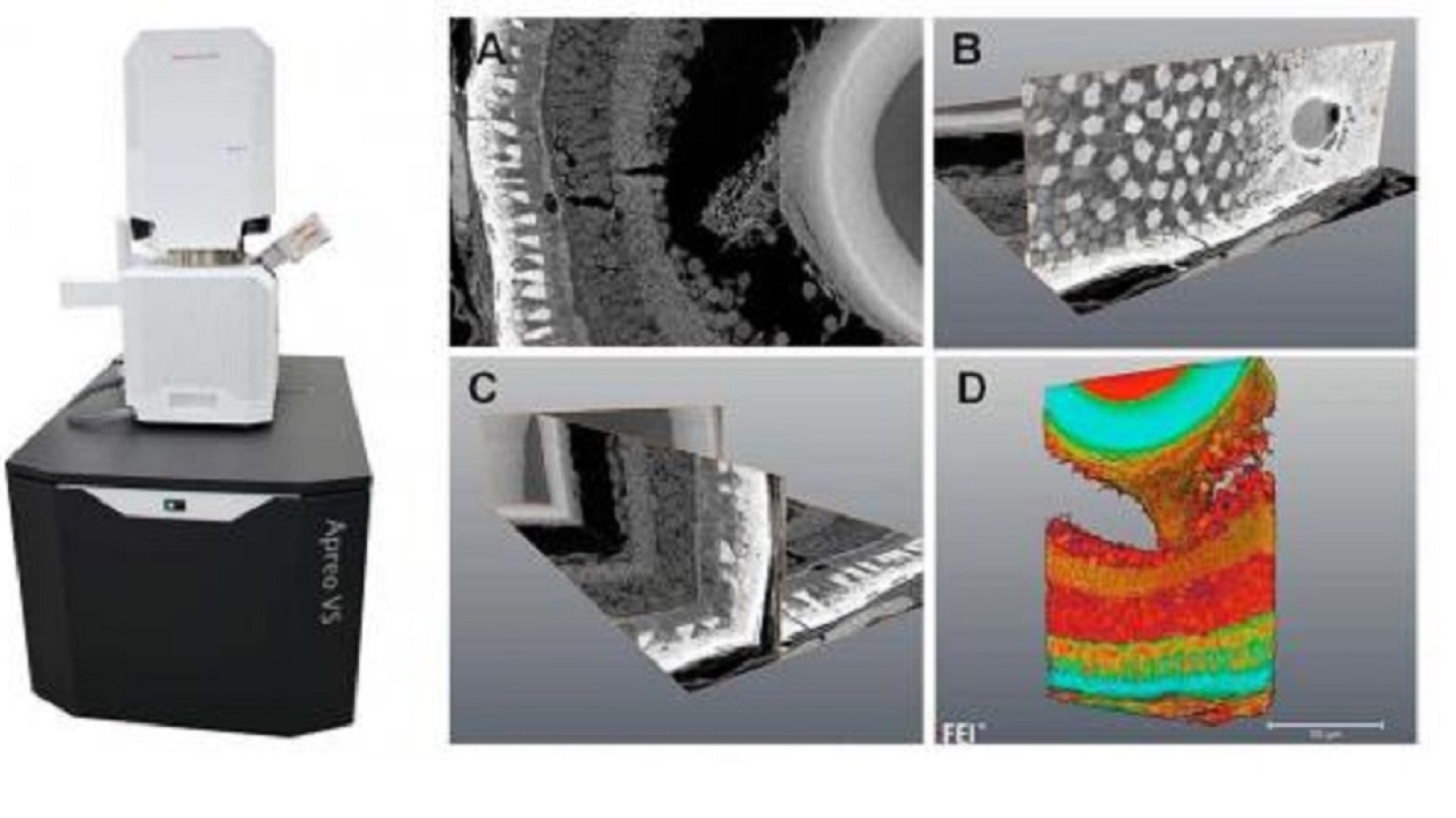 Thermo Apreo VS SEM for serial block-face imaging | Biomed Core ...
